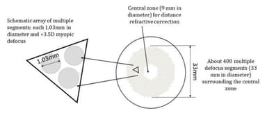 Carina Eye Care | Blogs | Stellest vs Miyosmart Spectacle Lenses for ...